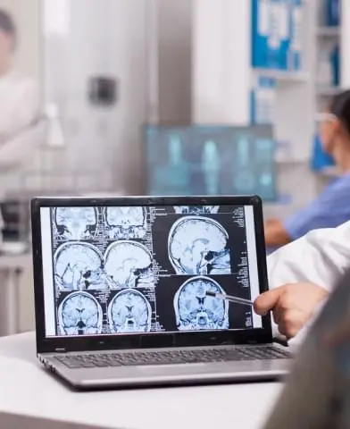 Teens and Vaping: A Trend We Can’t Ignore - Indiana Center for Recovery