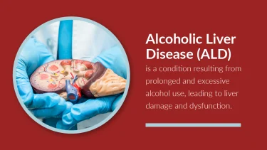 What Is Alcoholic Liver Disease (ALD) - Indiana Center for Recovery